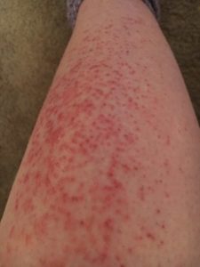 Can I Use Nair On My Back? Men's Back Hair Removal Cream Guide